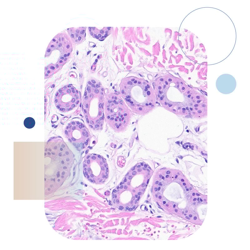 Dermatopathology | Pacific Dermatology Institute